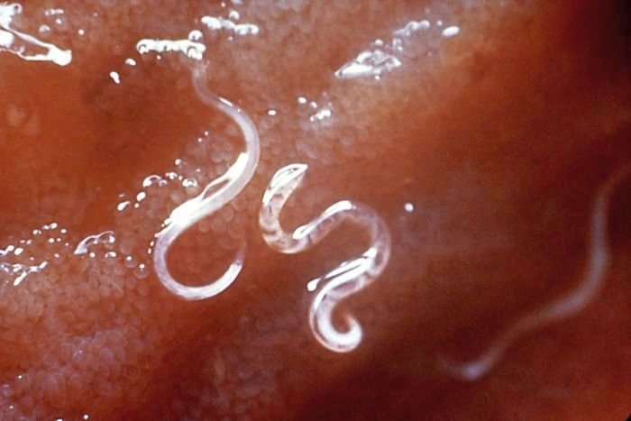 Hookworm — Science Learning Hub