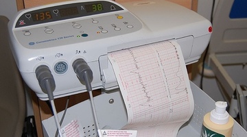 ECG monitor — Science Learning Hub