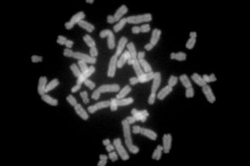 Human chromosomes — Science Learning Hub