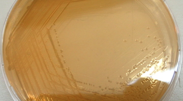 Salmonella sample — Science Learning Hub