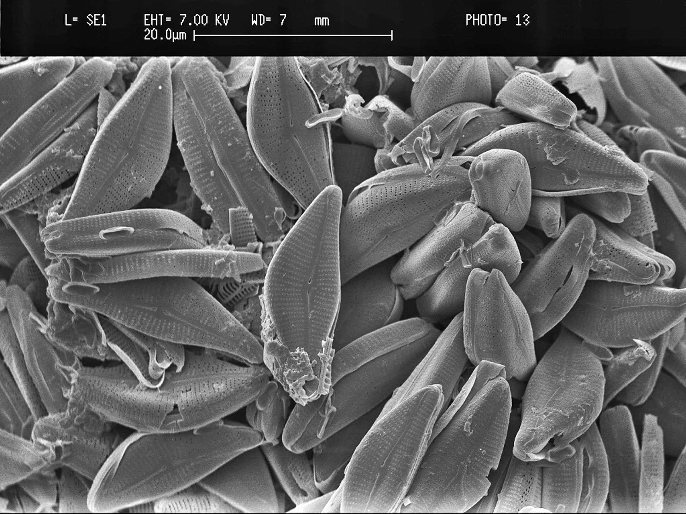 Diatom Electron Microscope